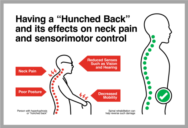 Chiropractic BioPhysics – The Science of Spinal Health