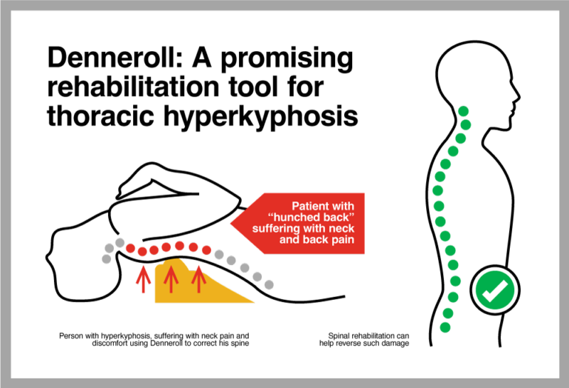 Chiropractic BioPhysics – The Science of Spinal Health