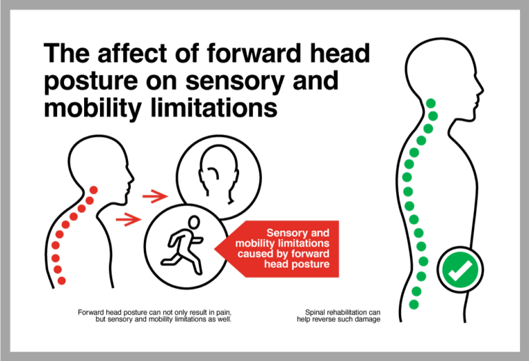 Why is Your Spine S-Shaped? The Importance of Spinal Curves ...