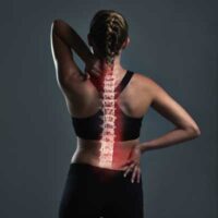 Chiropractic BioPhysics – The Science of Spinal Health